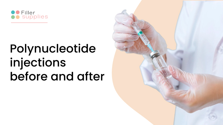 Polynucleotide Injections Before and After: Top 10 Things to Know ...